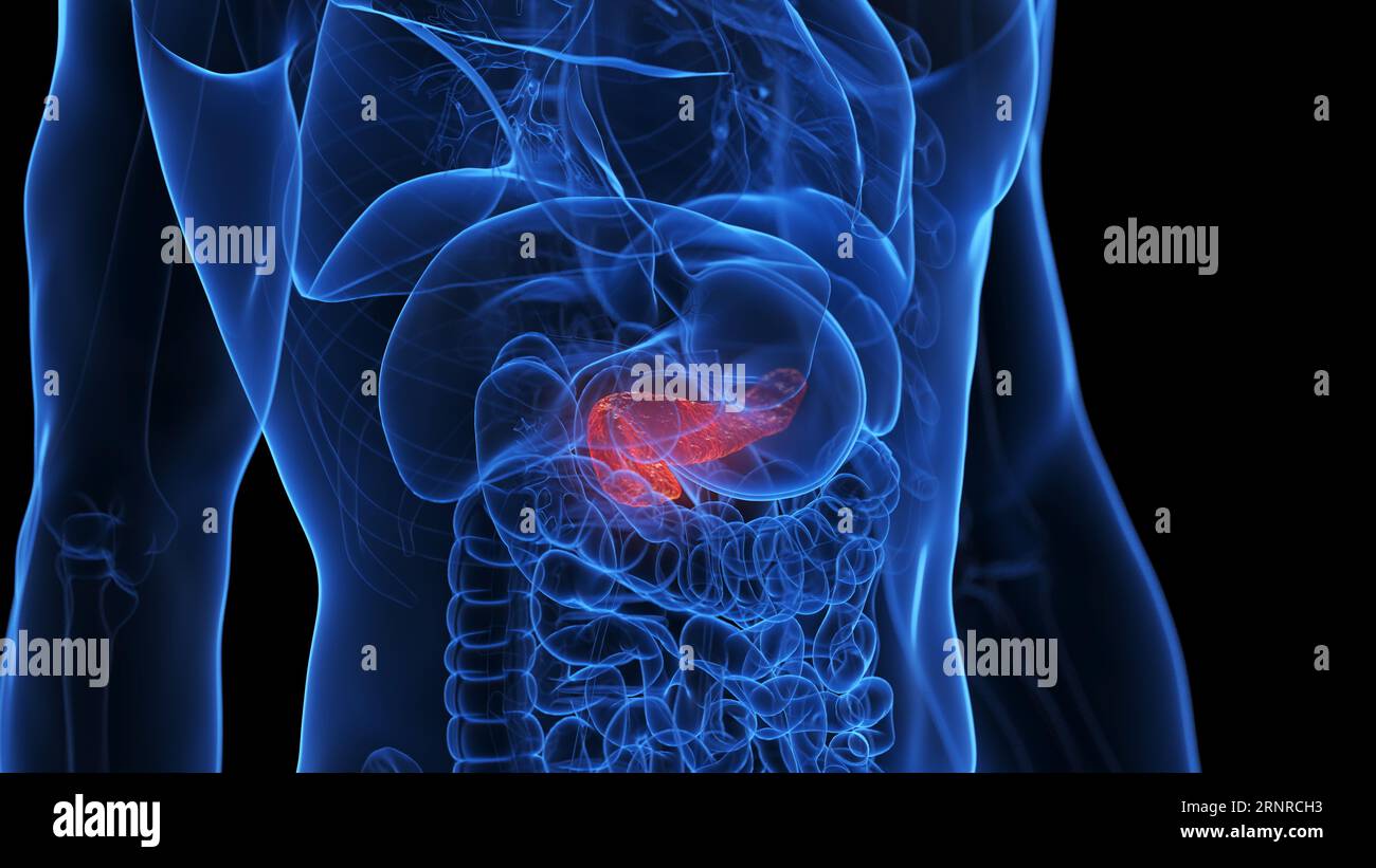 Inflamed pancreas hi-res stock photography and images - Alamy