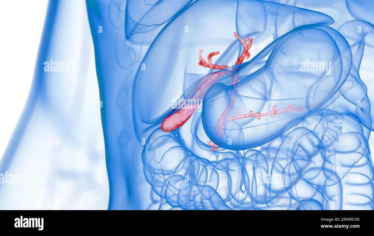 Inflamed gallbladder, illustration Stock Photo - Alamy
