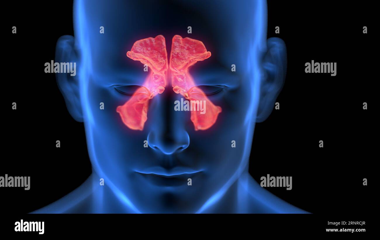 Inflamed sinuses, illustration Stock Photo - Alamy