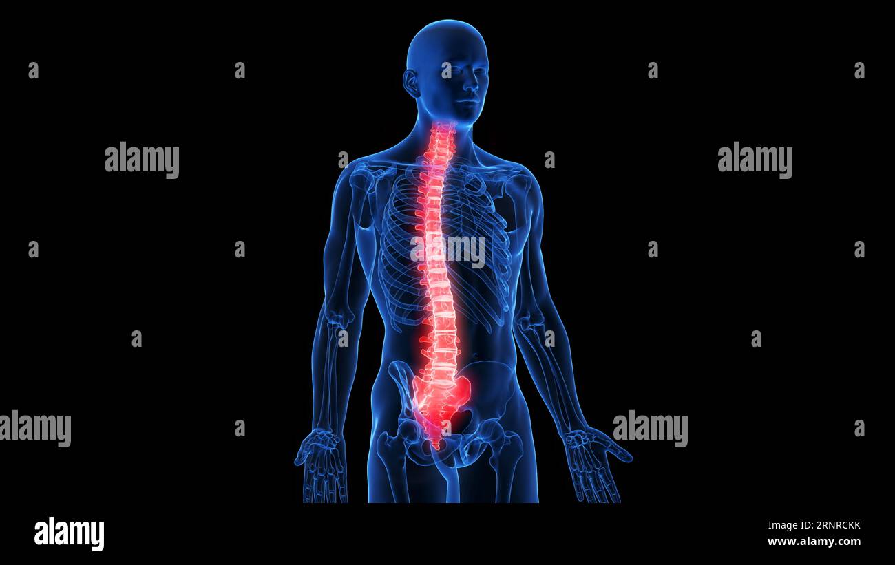 Painful spine, illustration Stock Photo - Alamy