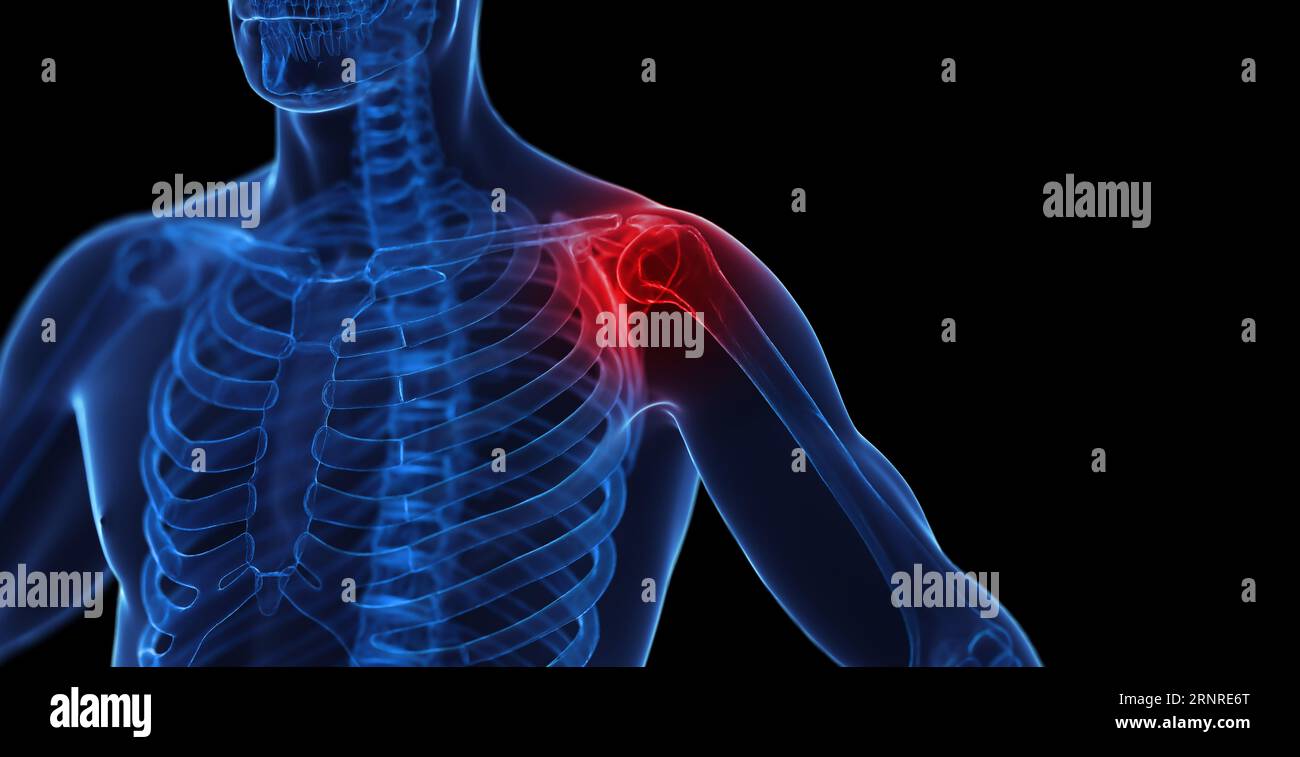 Male shoulder, illustration Stock Photo - Alamy