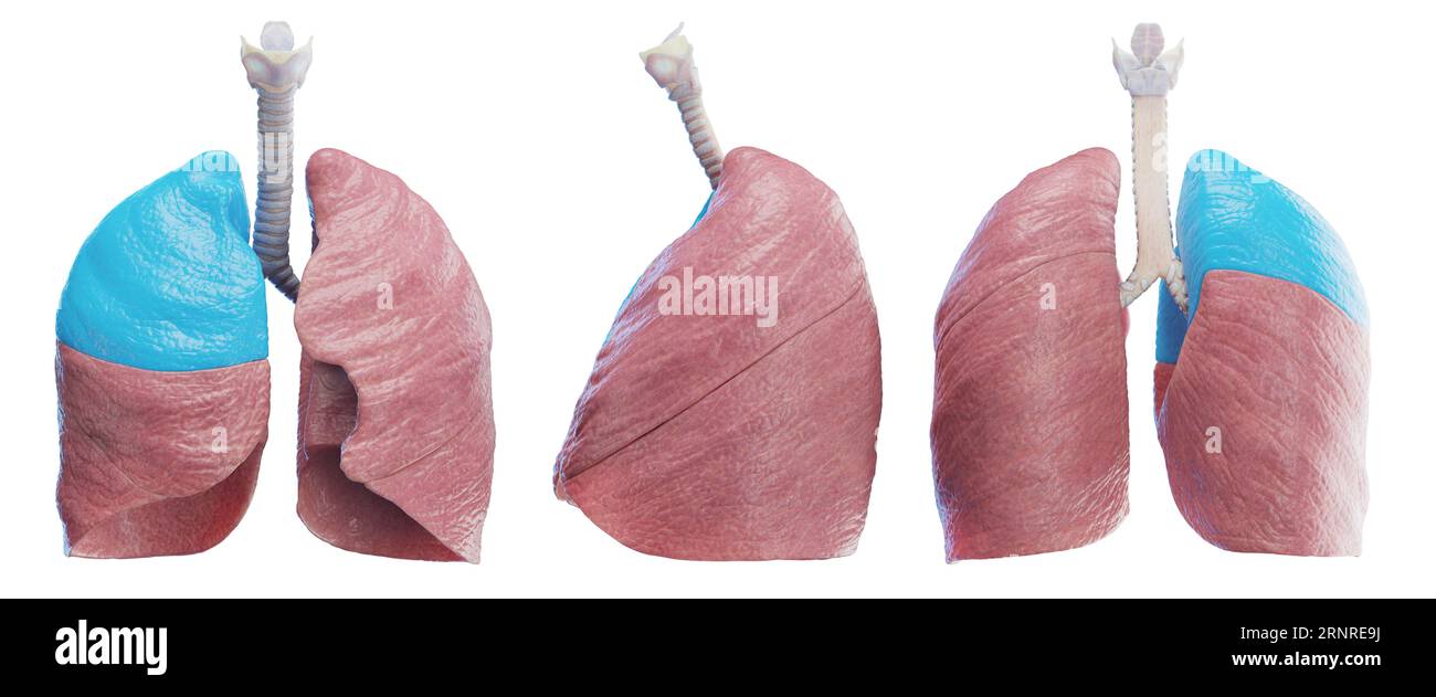 Lung apex hi-res stock photography and images - Alamy