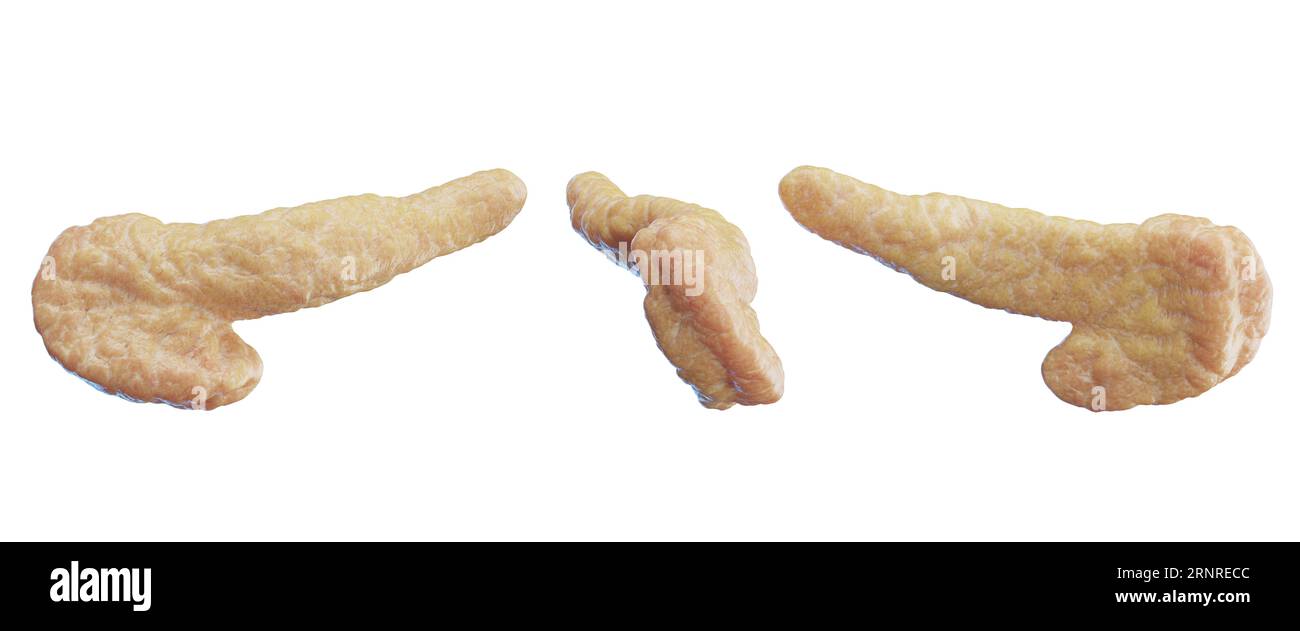 Tail of pancreas hi-res stock photography and images - Alamy