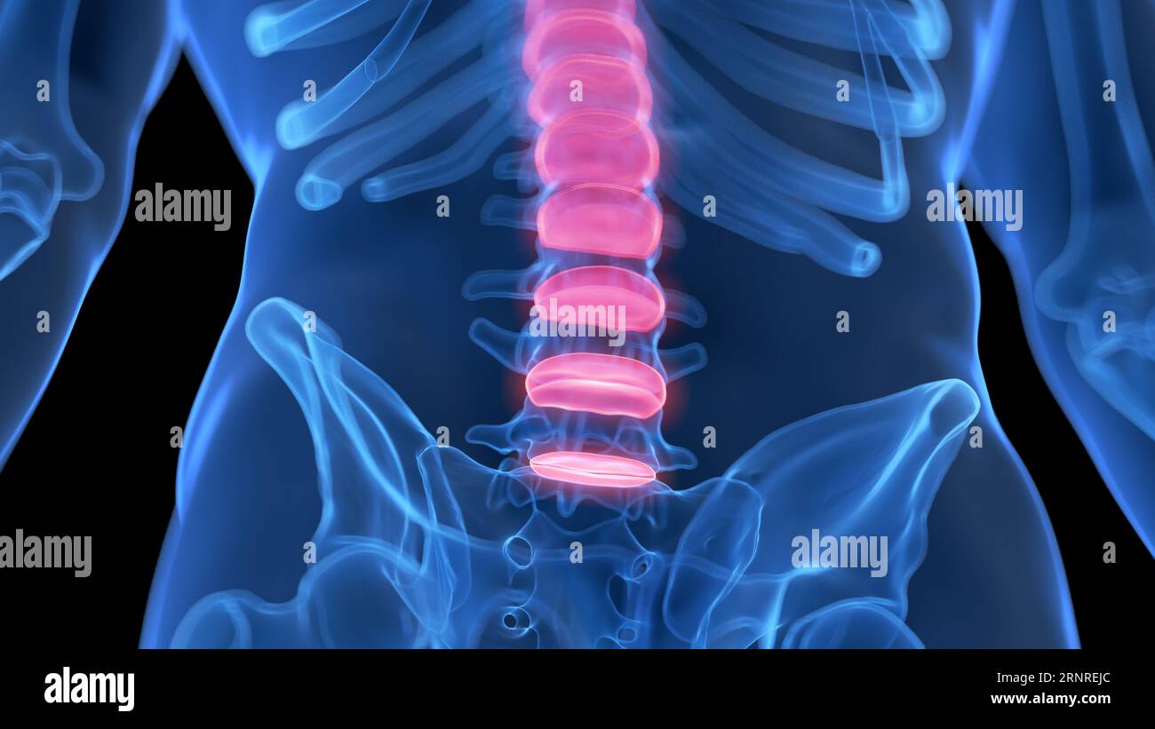 Intervertebral discs, illustration Stock Photo - Alamy