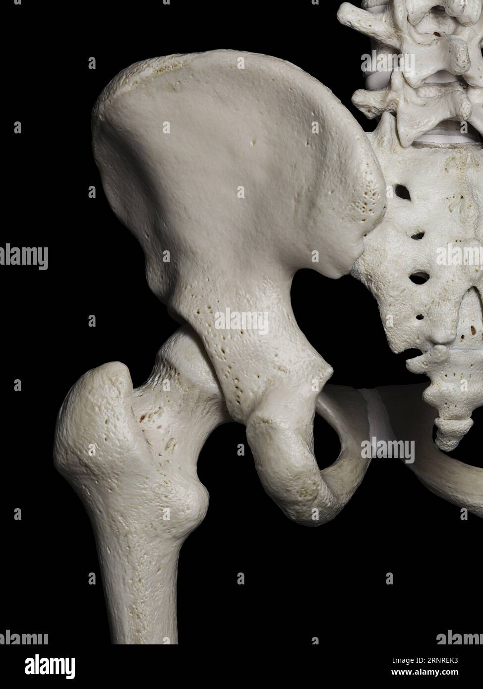 Hip joint, illustration Stock Photo - Alamy