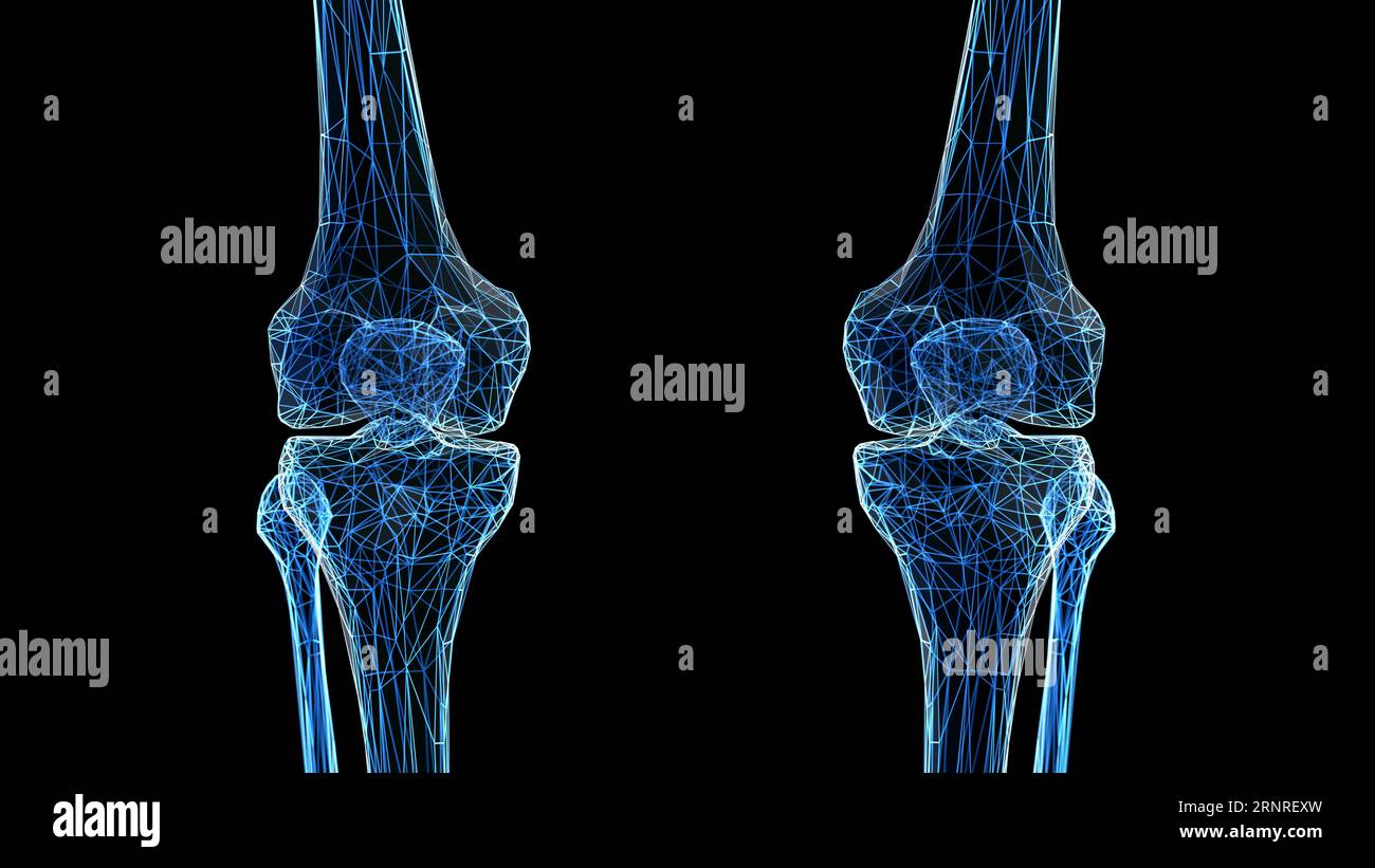 Knee bones, illustration Stock Photo - Alamy