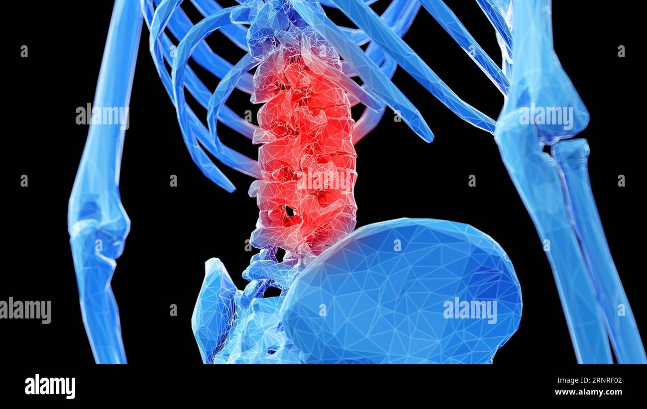 Lower spine bones, illustration Stock Photo - Alamy