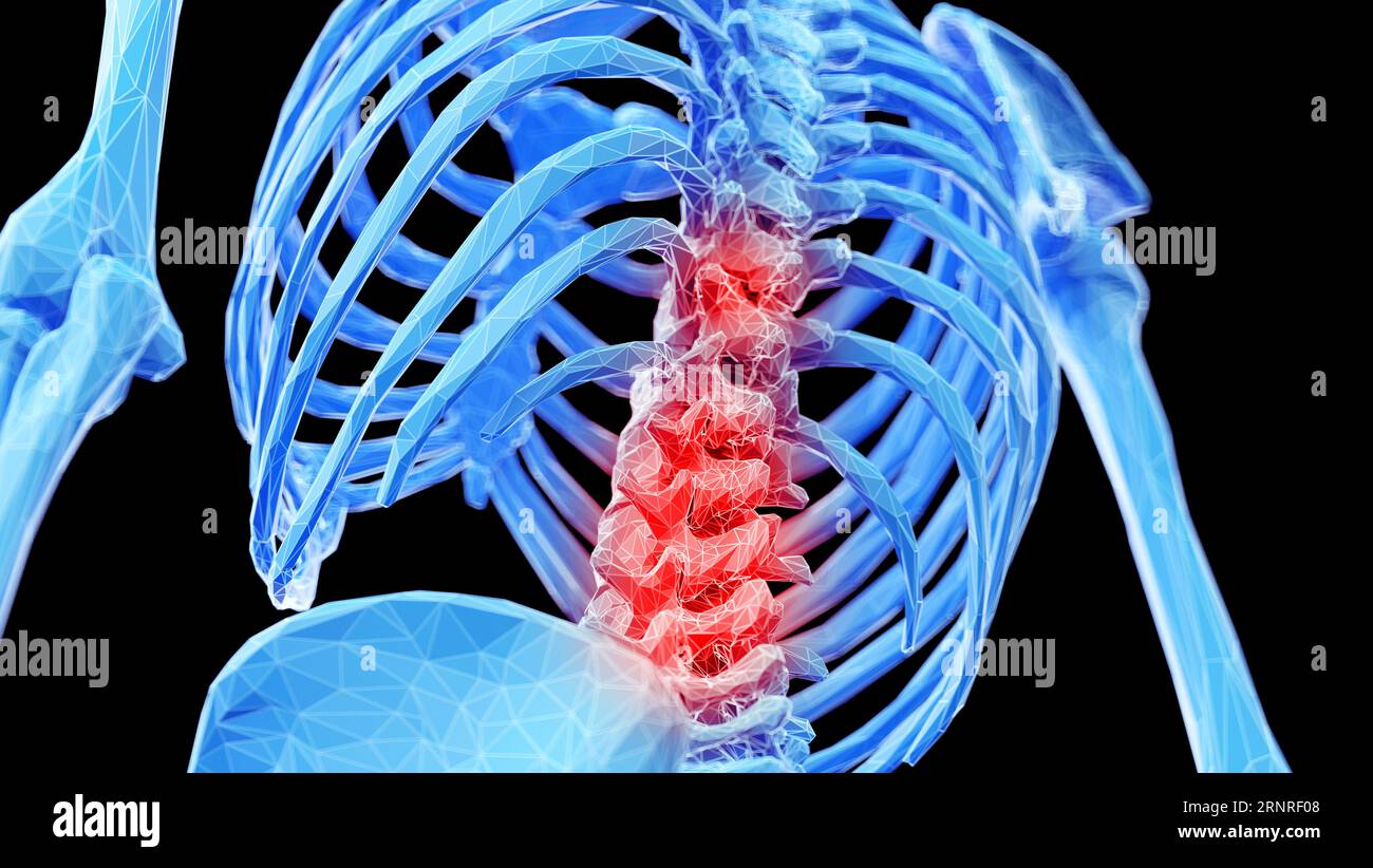 Back bones, illustration Stock Photo - Alamy