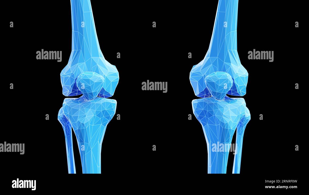 Knee bones, illustration Stock Photo - Alamy