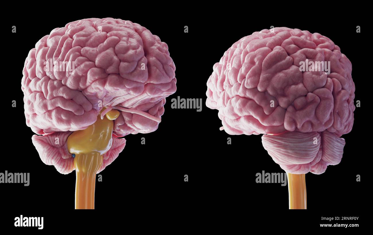 Brainstem cerebellar hi-res stock photography and images - Alamy