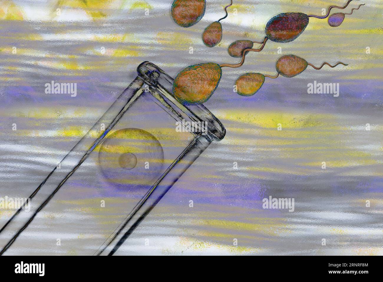 In vitro fertilisation, conceptual illustration Stock Photo - Alamy