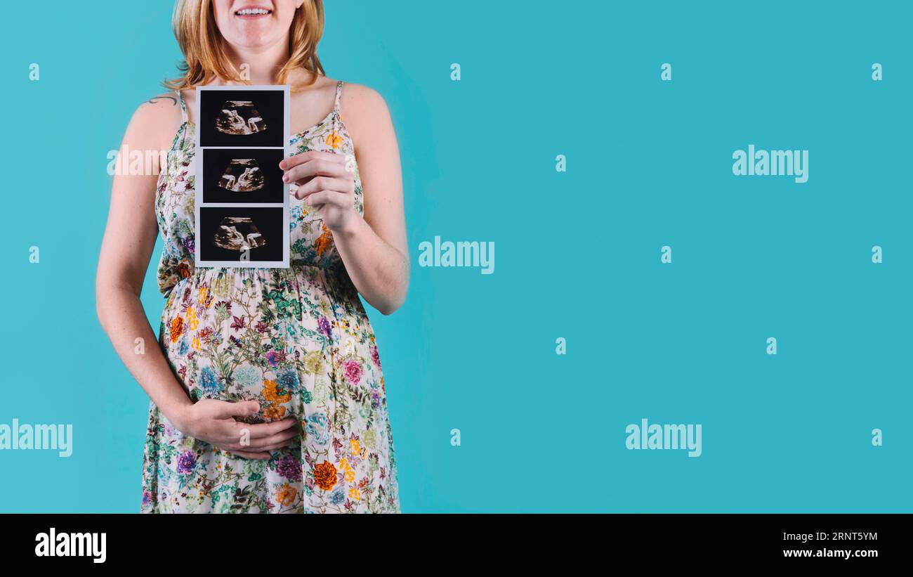 Ray image pregnant woman hi-res stock photography and images - Alamy