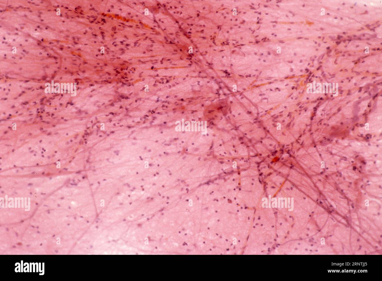 Light micrograph of human neurons.100x magnification Stock Photo - Alamy
