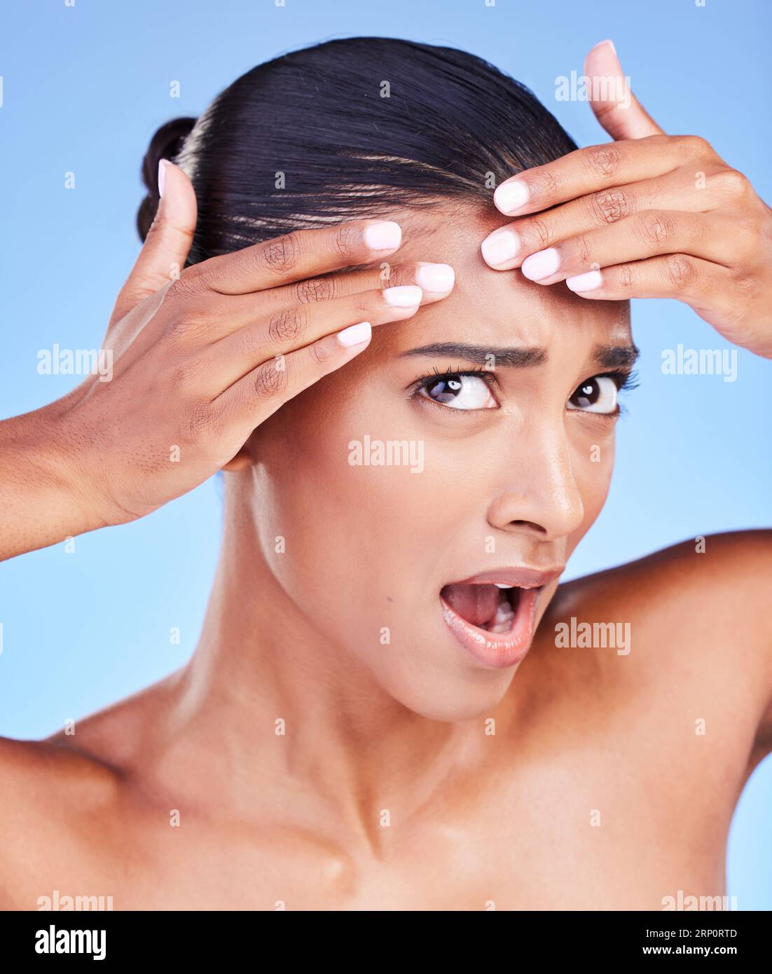 Shock, pimple and young woman in studio for cosmetic, beauty and ...