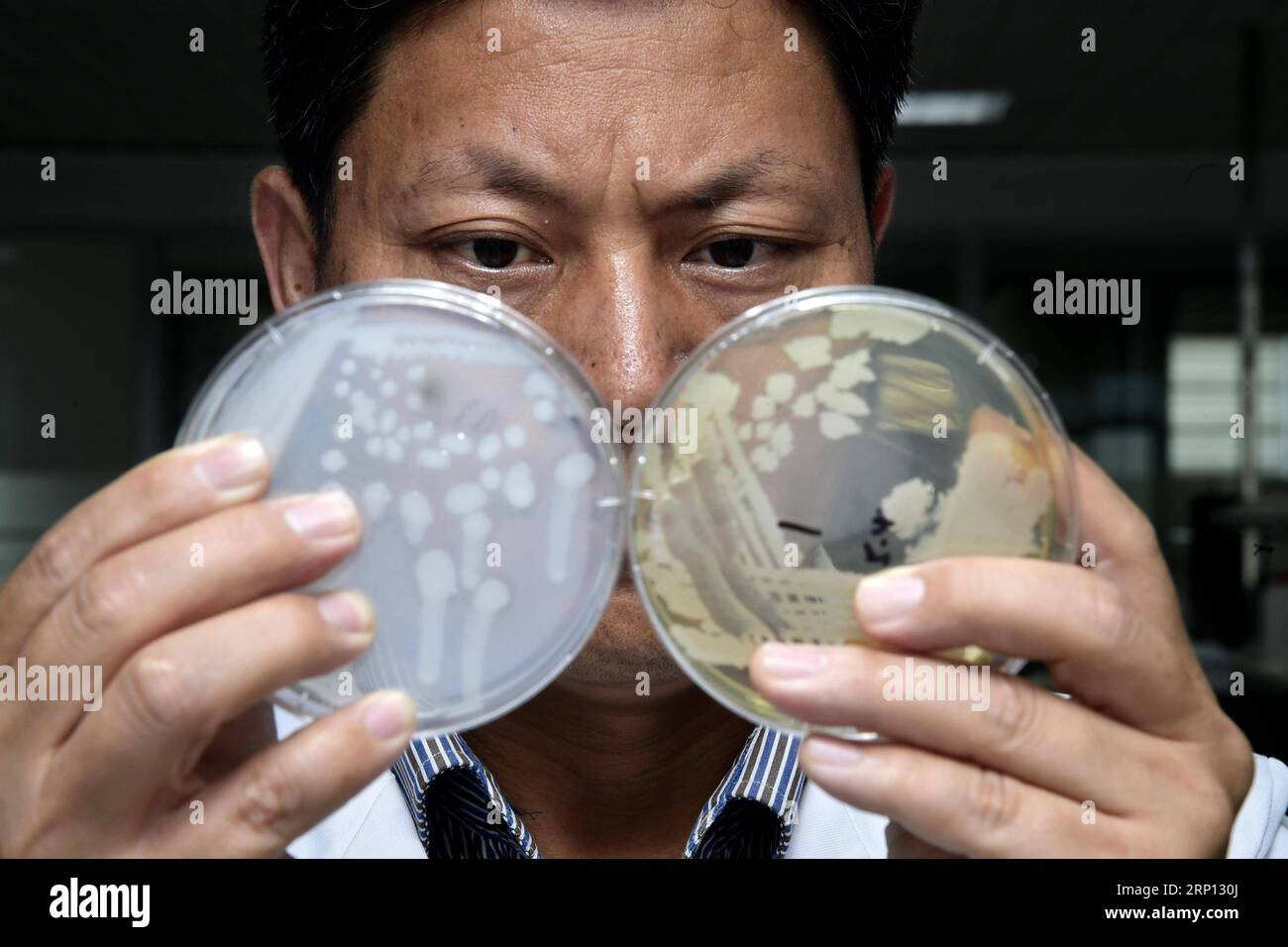 Mcg common hi-res stock photography and images - Alamy