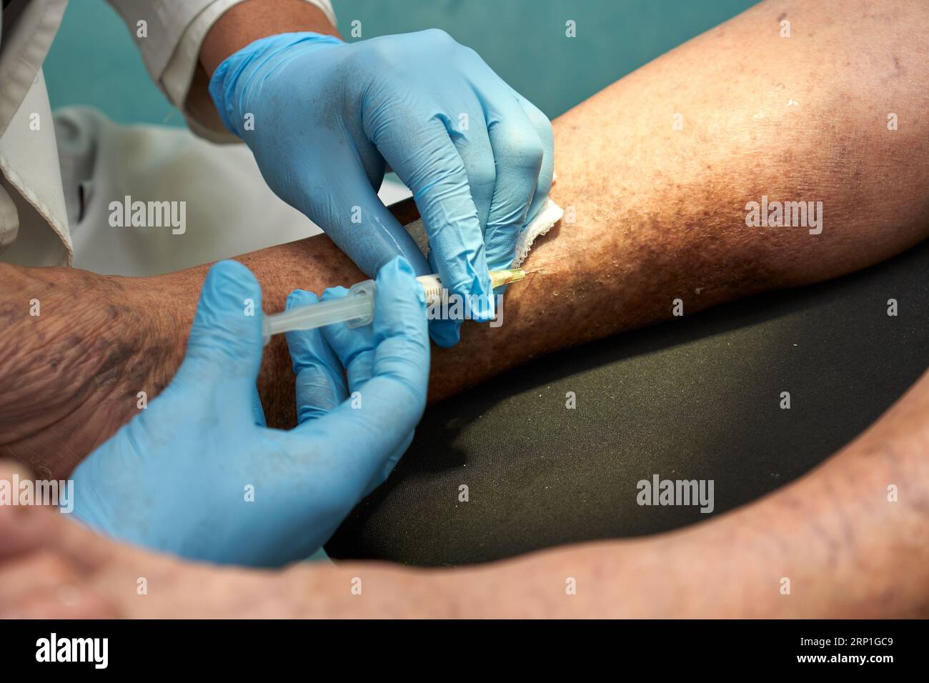 Improve blood circulation hi-res stock photography and images - Alamy