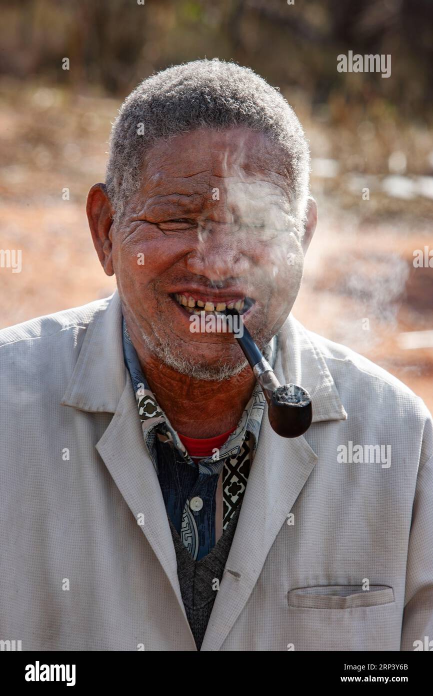 Unhealthy Teeth Smoking
