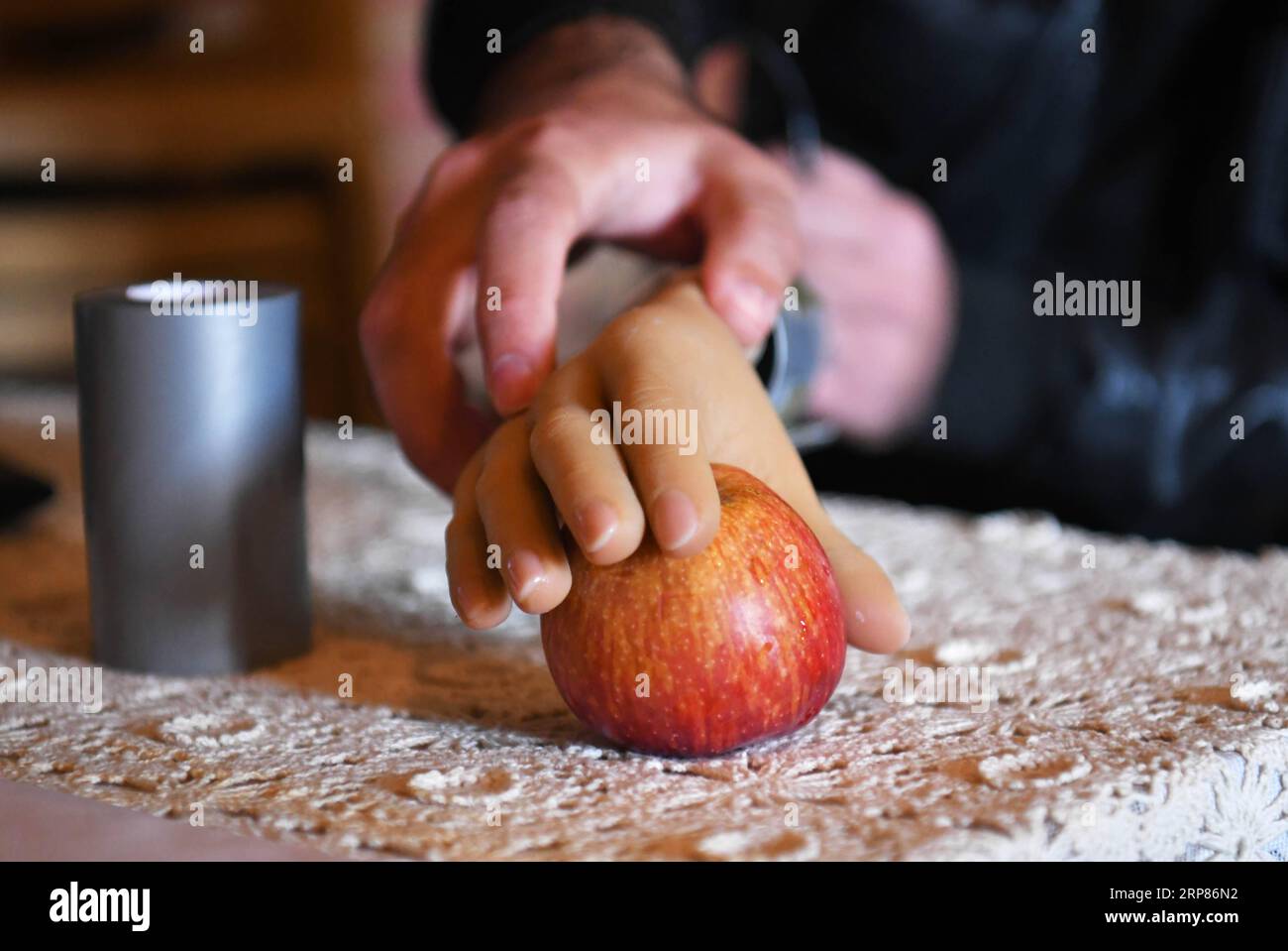 (190220) -- HAMA, Feb. 20, 2019 -- Ali Bakeer tests a prosthetic hand ...