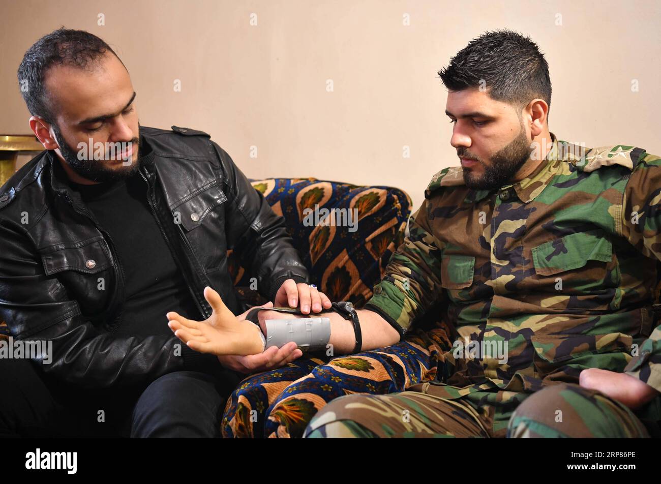 (190220) -- HAMA, Feb. 20, 2019 -- Ali Bakeer (L) installs a prosthetic ...