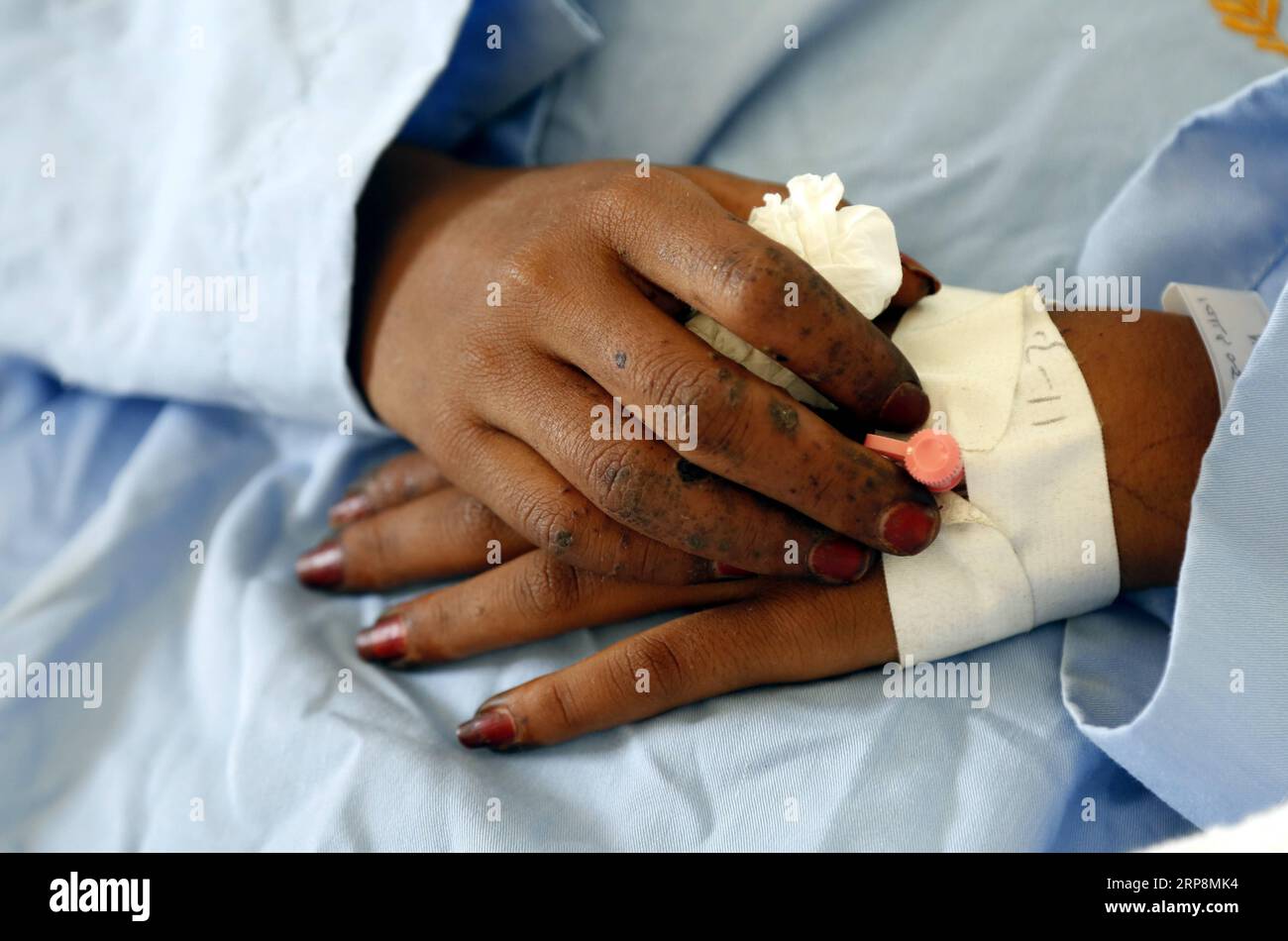 Child injured on bed in hi-res stock photography and images - Alamy