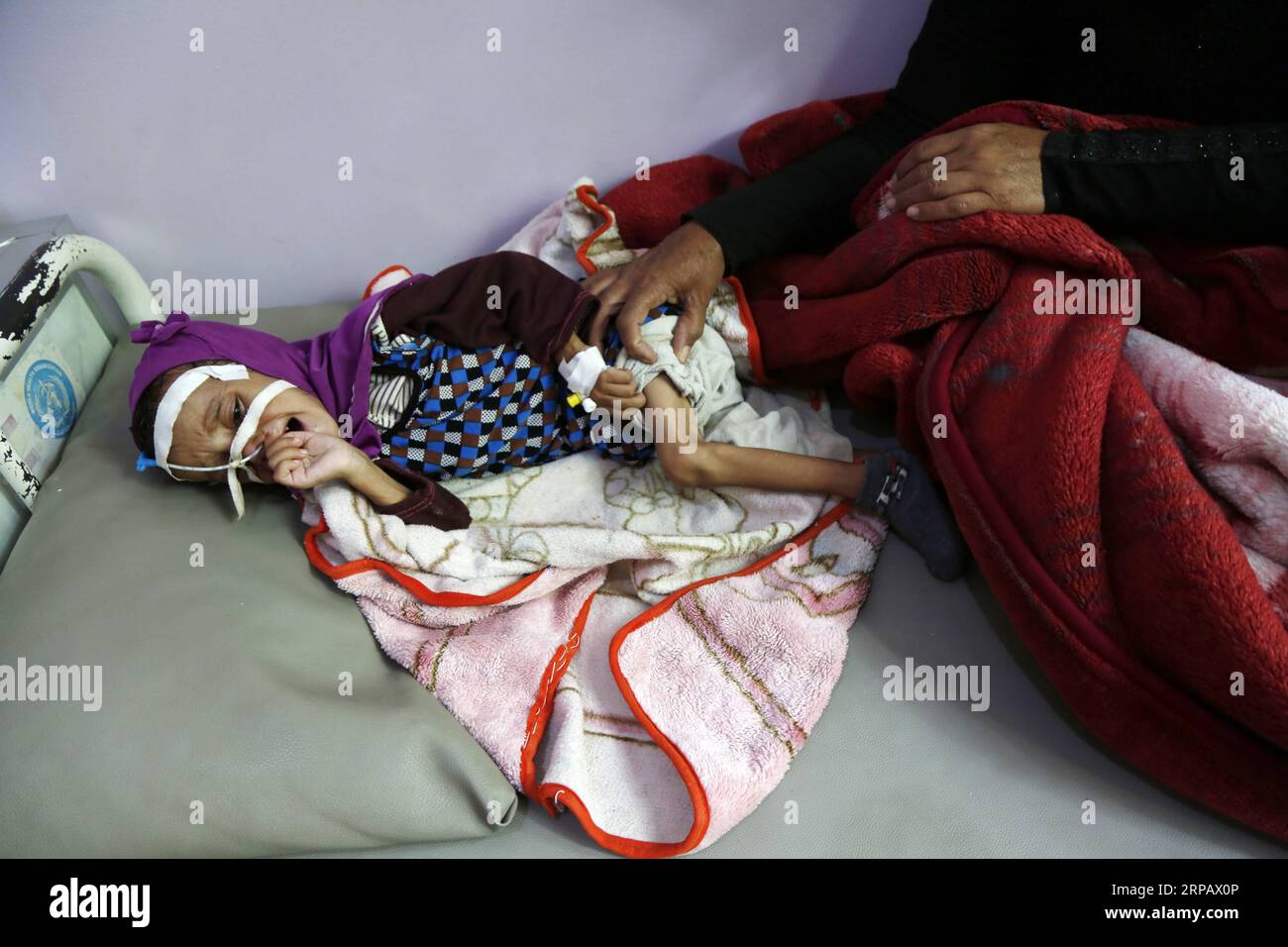 Stunted children hi-res stock photography and images - Alamy