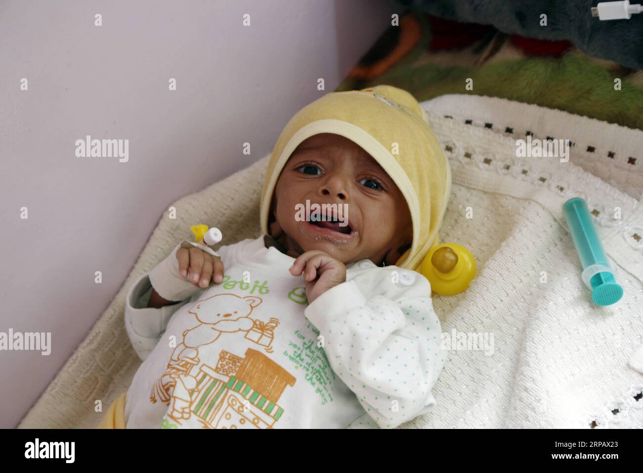 Stunted children hi-res stock photography and images - Alamy