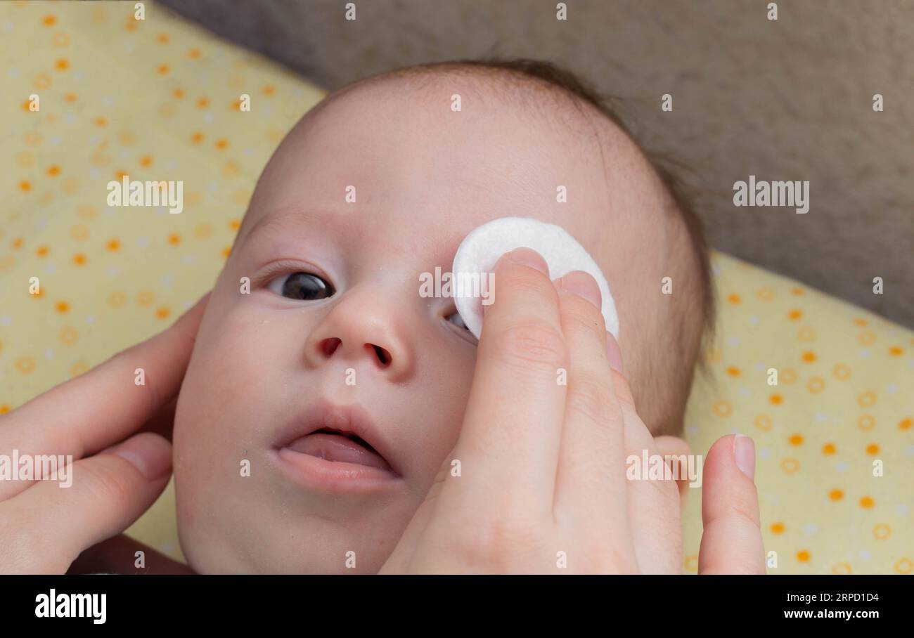 Cotton pad eye hi-res stock photography and images - Alamy