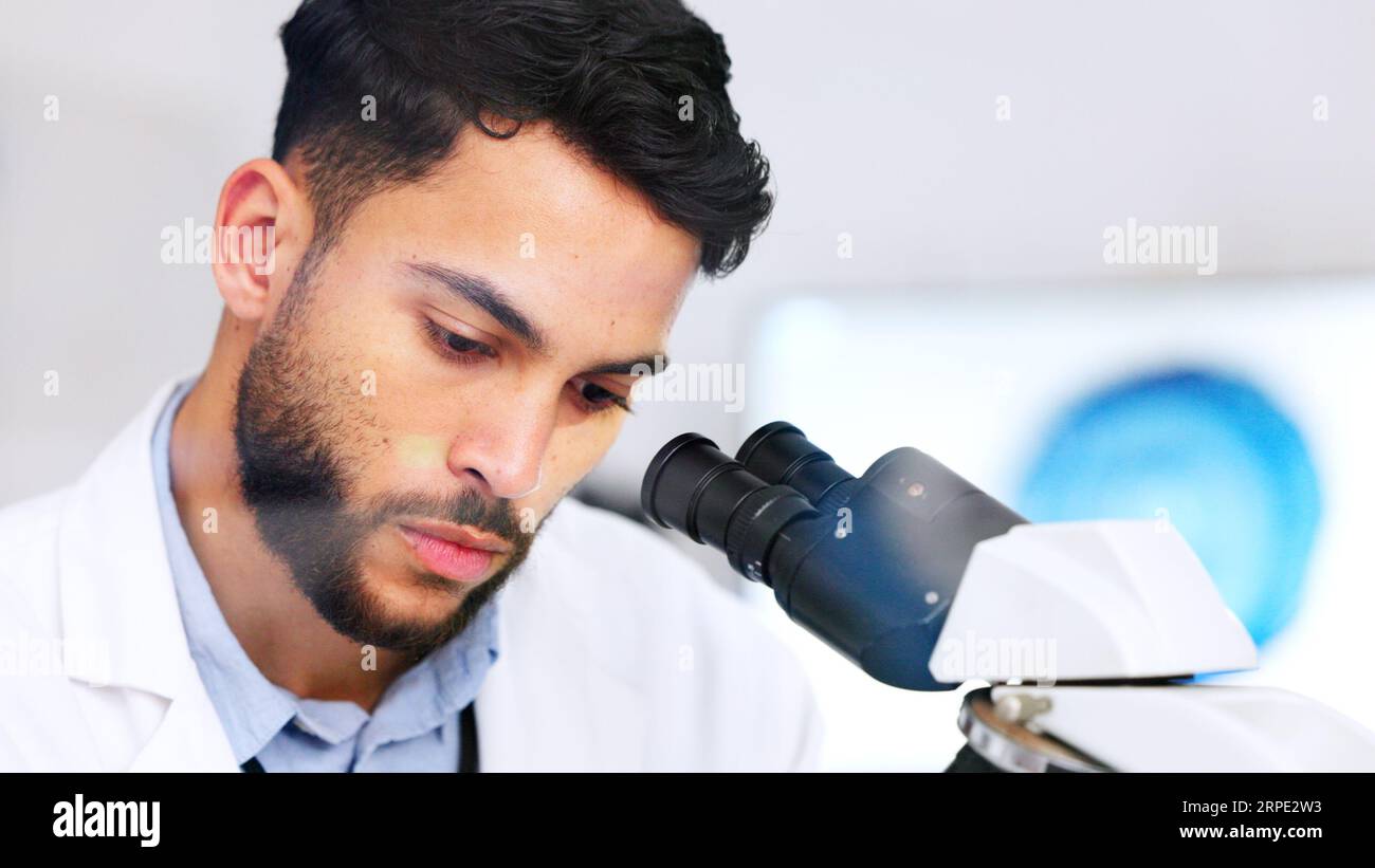 Monkeypox microscope hi-res stock photography and images - Alamy