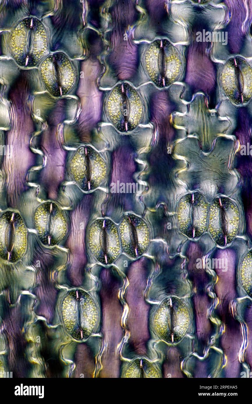 Lily Leaf Epidermis Labeled at Mitchell Fredricksen blog