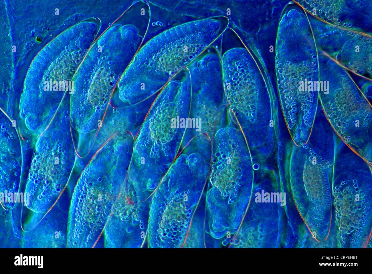 The image presents diptera eggs, photographed through the microscope in ...