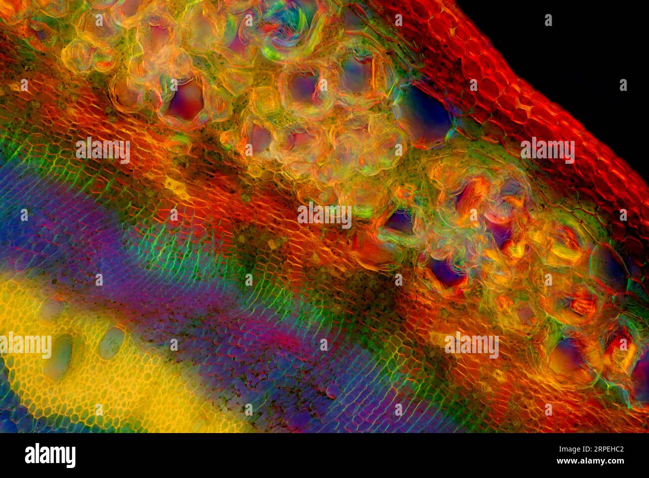 The image presents nettle tissues in the stalk in transversall cross ...