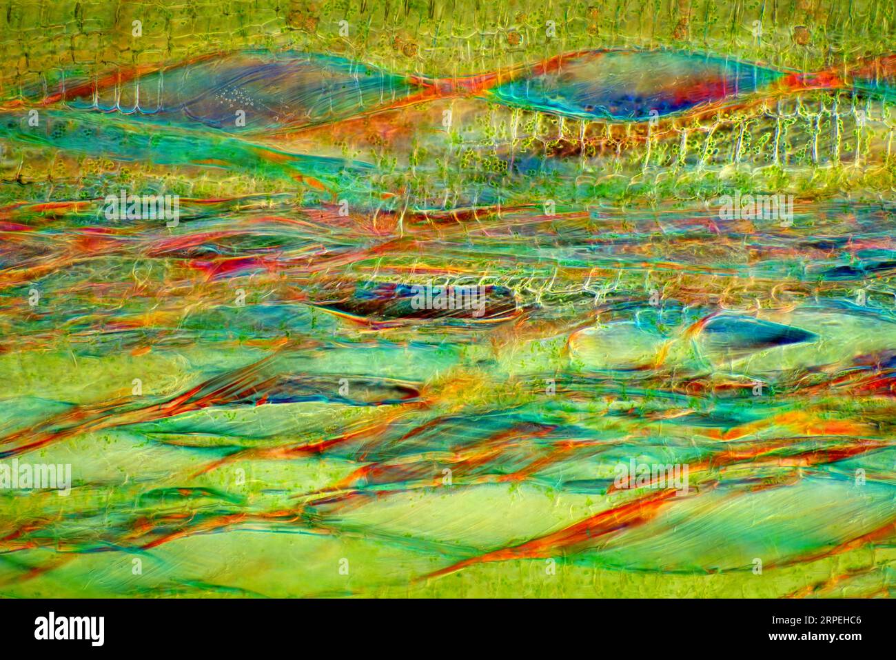 The image presents nettle tissues in the stalk in longitudinal cross ...