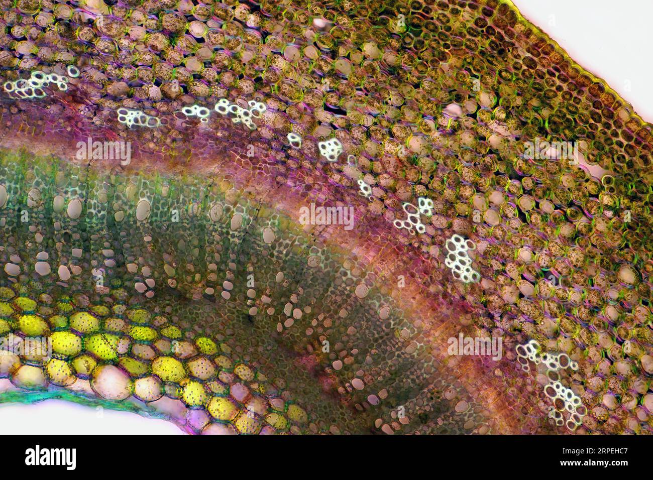 The image presents a small part of forsythia stalk tissues in ...