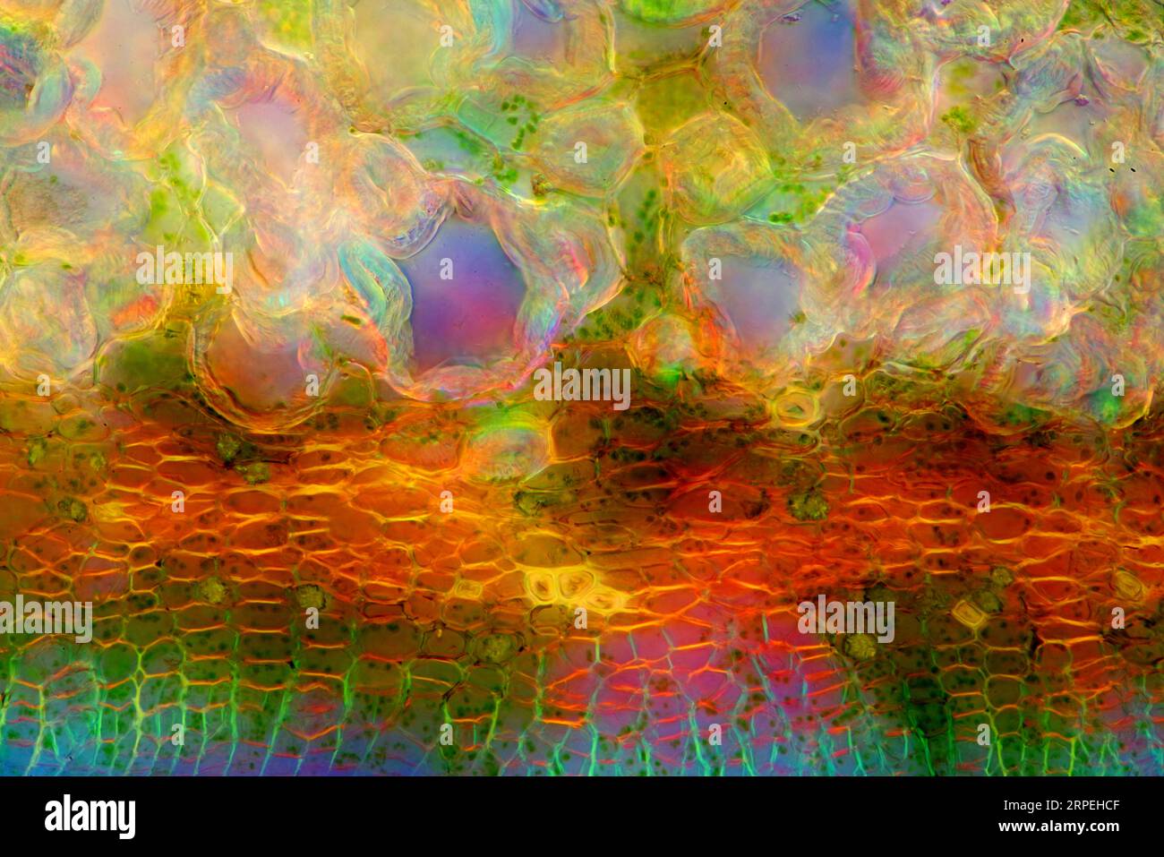 The image presents nettle tisues in the transversal cross-section of ...