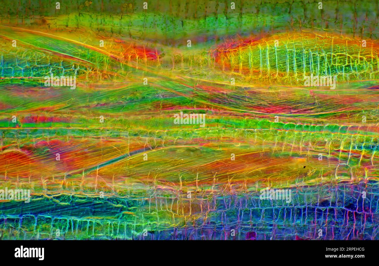 Tissues in nettle stalk photographed through the microscope Stock Photo ...