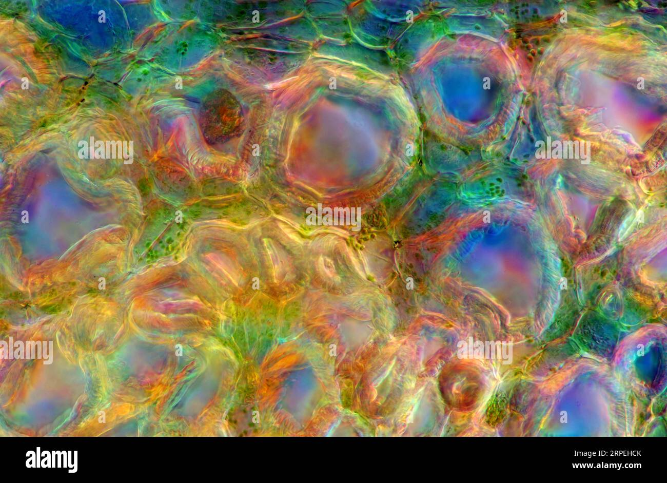 The image presents nettle tissues in the transversal section of the ...