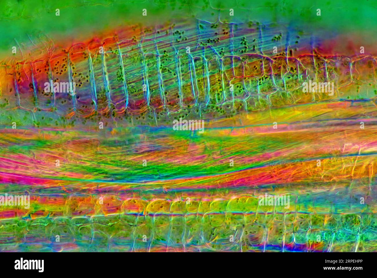 The image presents nettle tissues in the stalk in longitudinal cross ...