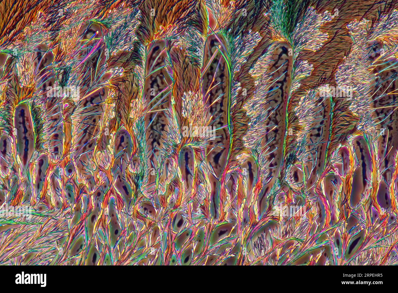 The image presents crystallized callus remover, photographed through ...