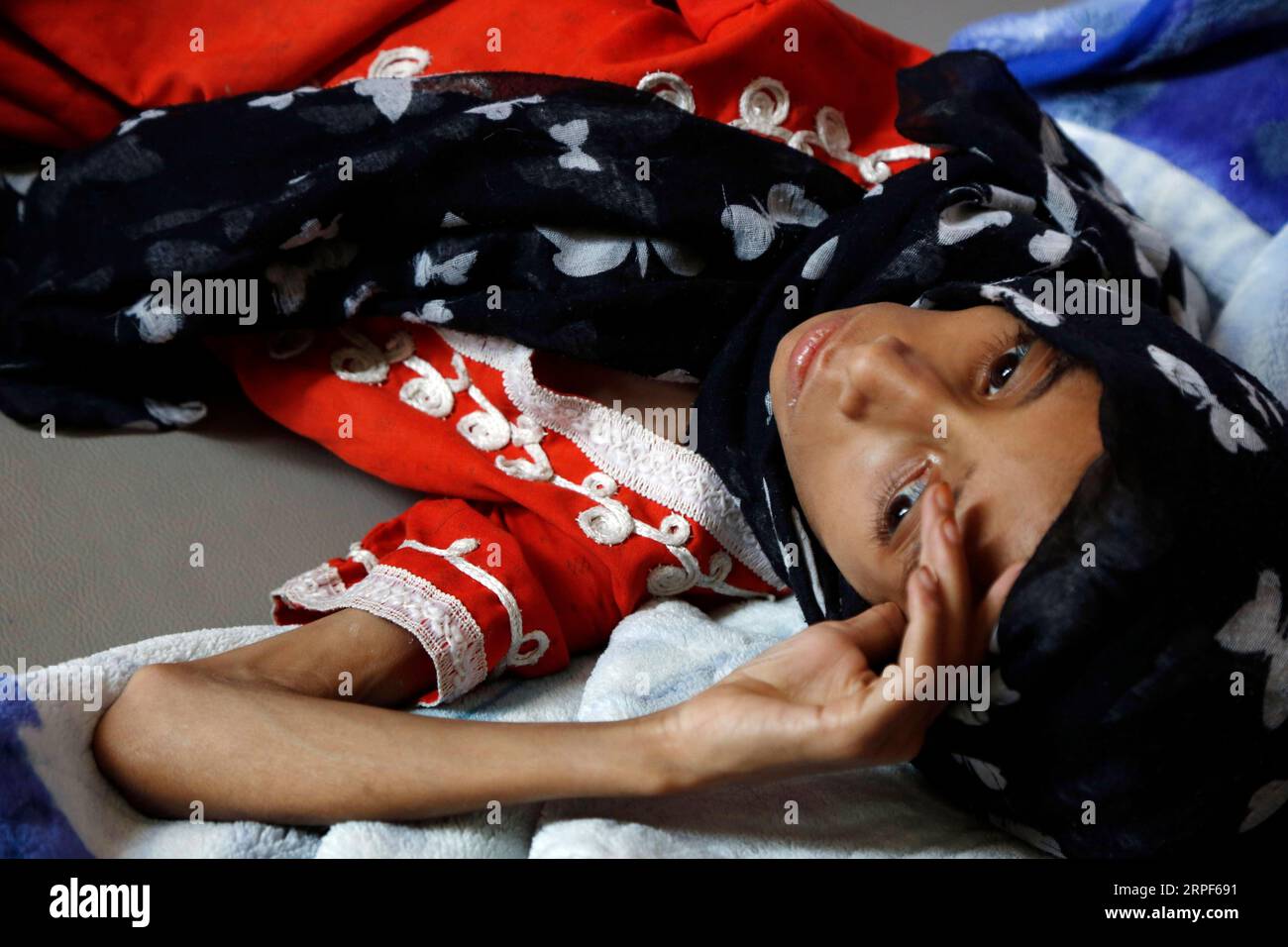 190914 -- SANAA, Sept. 14, 2019 -- Sadia Ibrahim lies on a bed as she ...