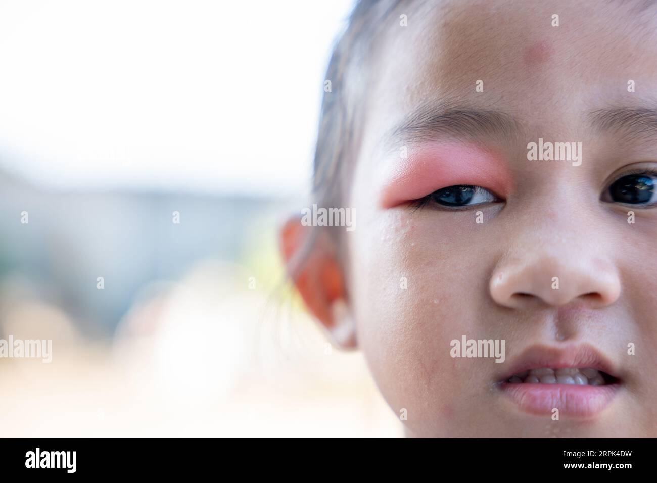 Stye child hi-res stock photography and images - Alamy