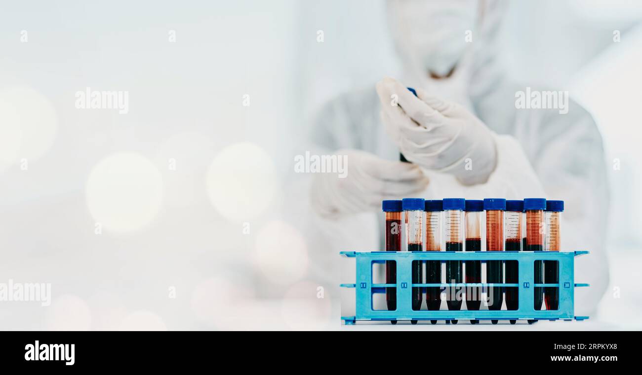 Blood test, DNA and science, scientist and banner, health and medical ...