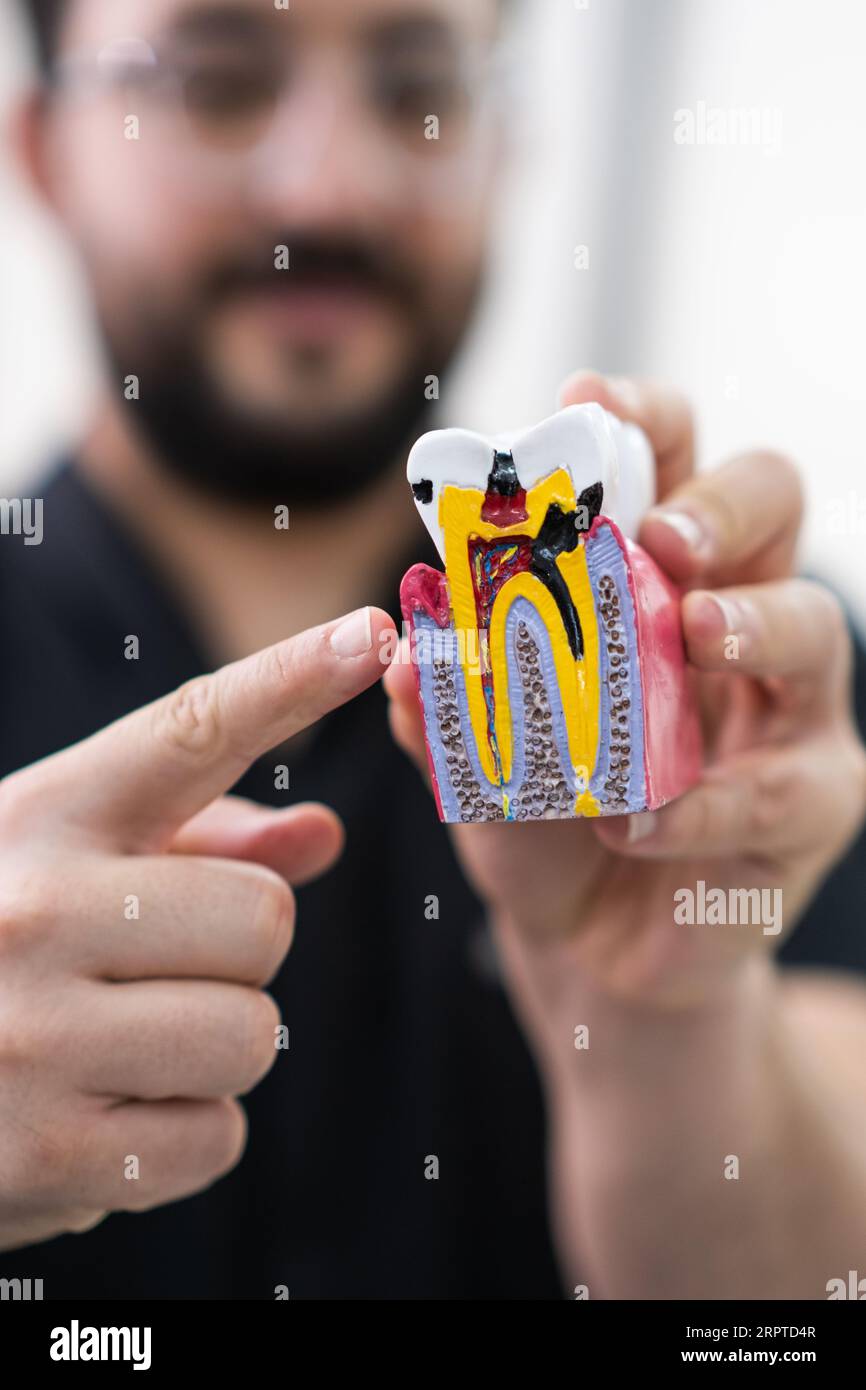 Dentist pointing to plastic model of human tooth with multiple caries ...