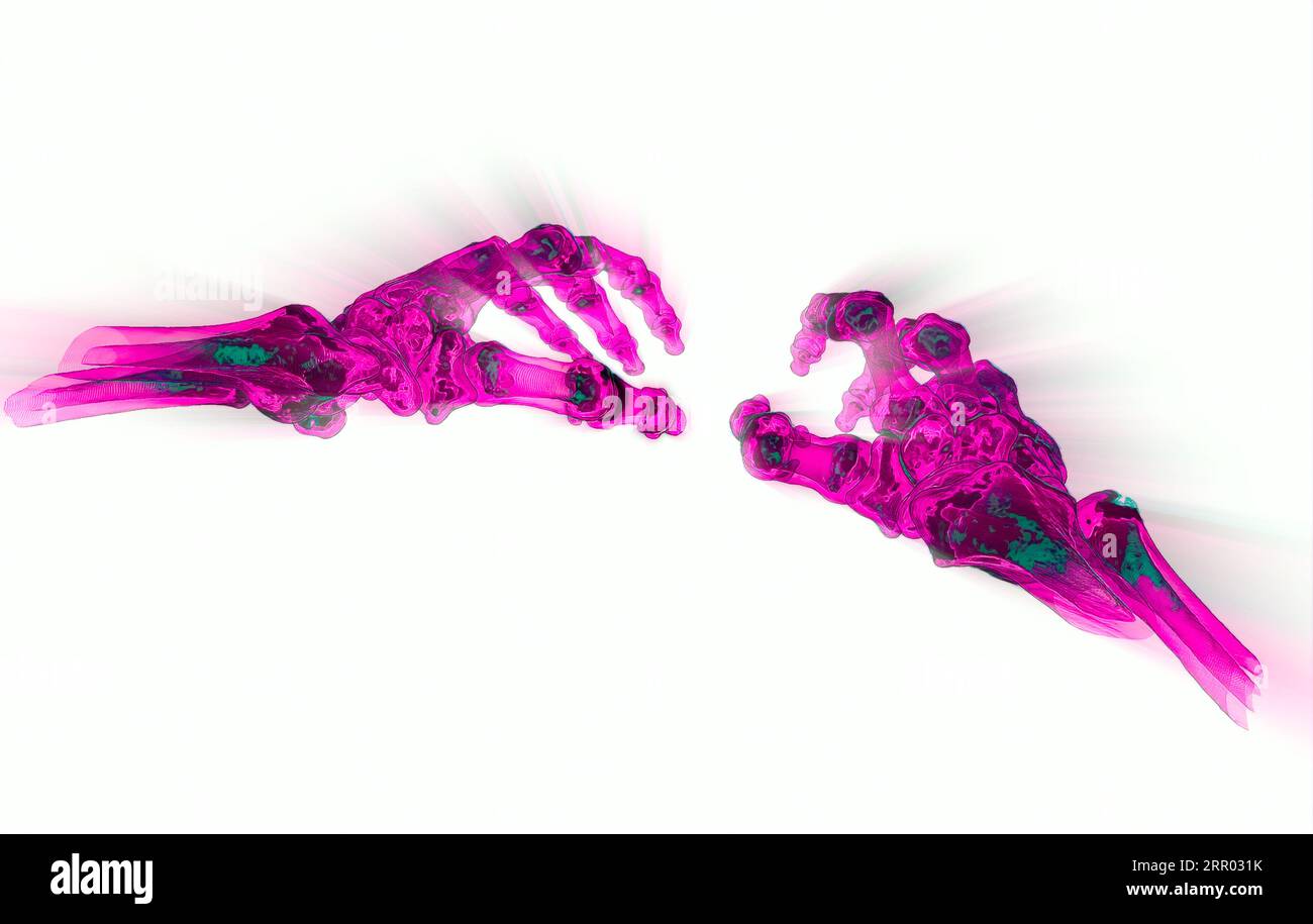 Hands and wrists, CT scan Stock Photo - Alamy