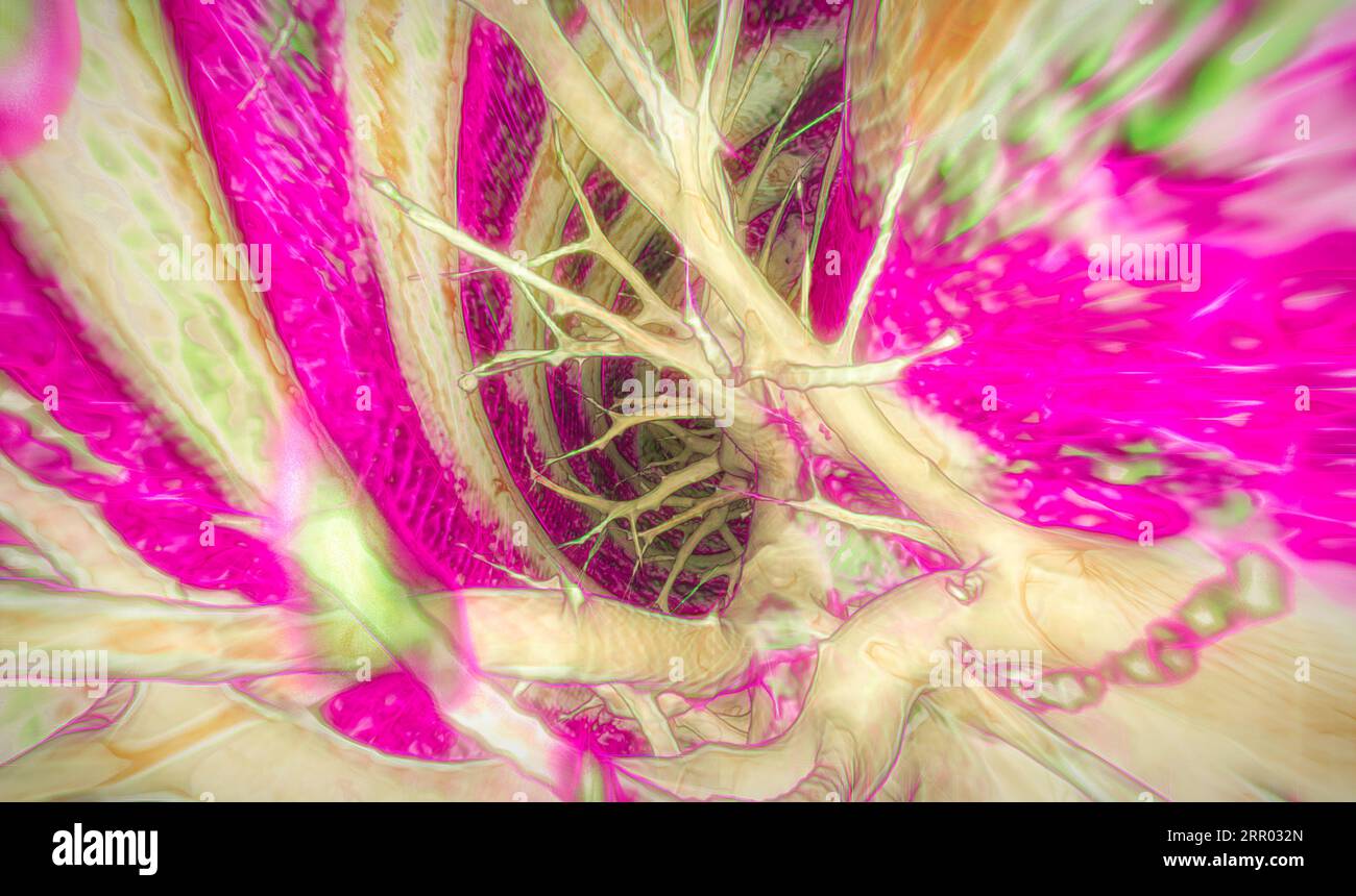 Healthy lung, CT scan Stock Photo - Alamy