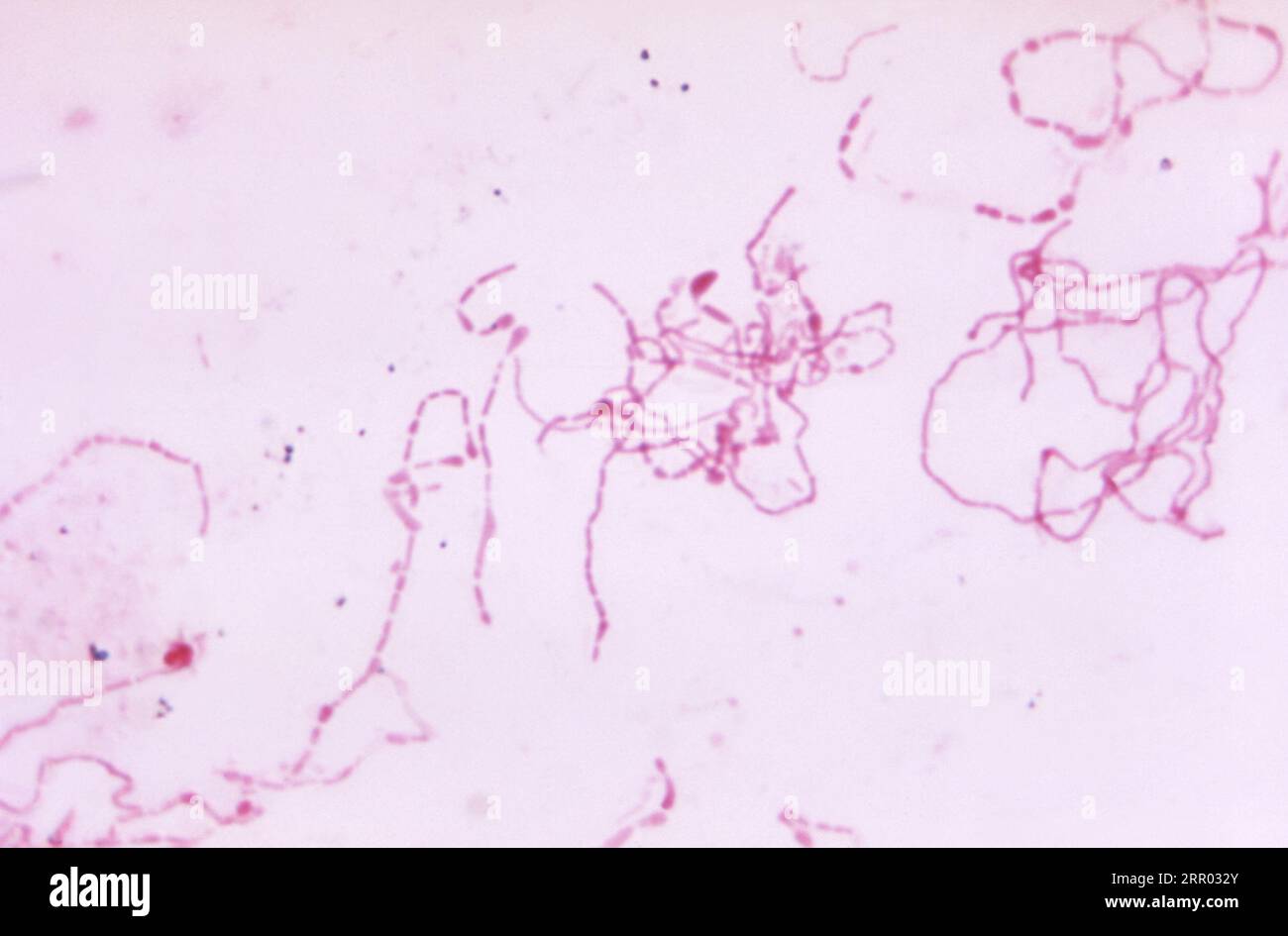 Rat bite fever bacteria, light micrograph Stock Photo - Alamy