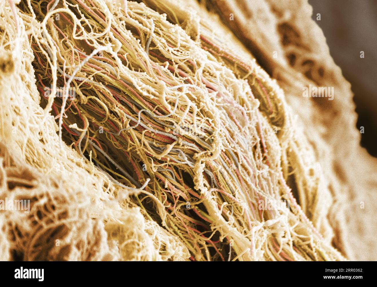 Human connective tissue, SEM Stock Photo - Alamy