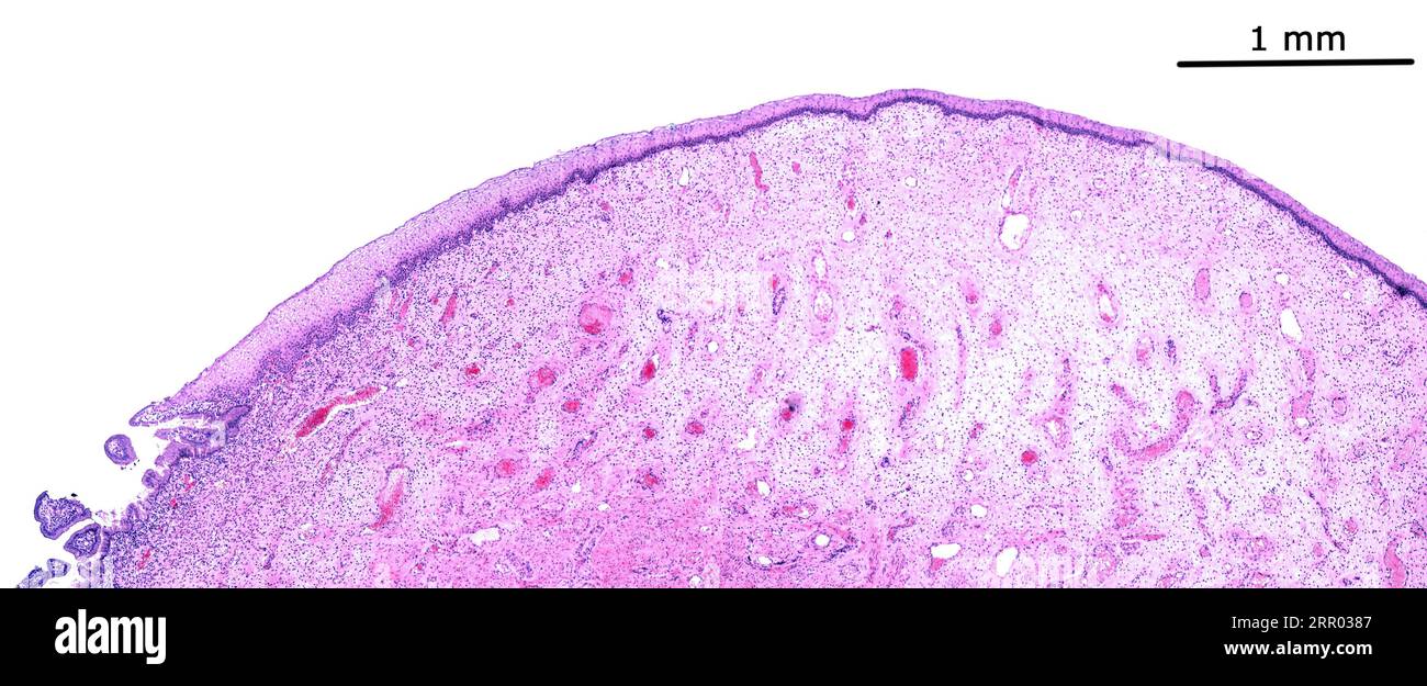 Human uterine cervix, light micrograph Stock Photo - Alamy