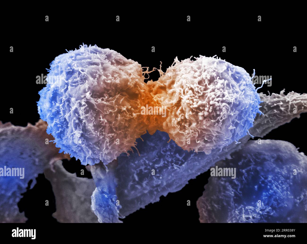 Prostate cancer cells dividing, SEM Stock Photo - Alamy
