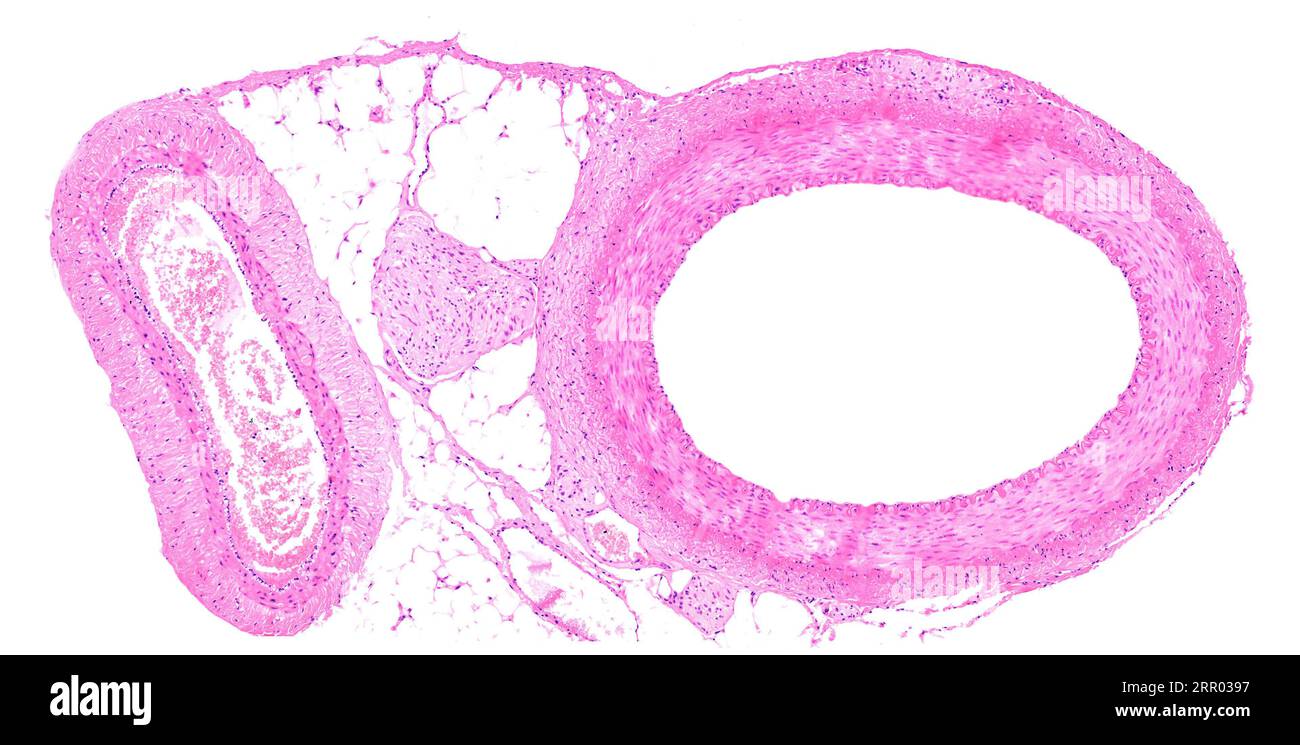 Artery and vein, light micrograph Stock Photo - Alamy
