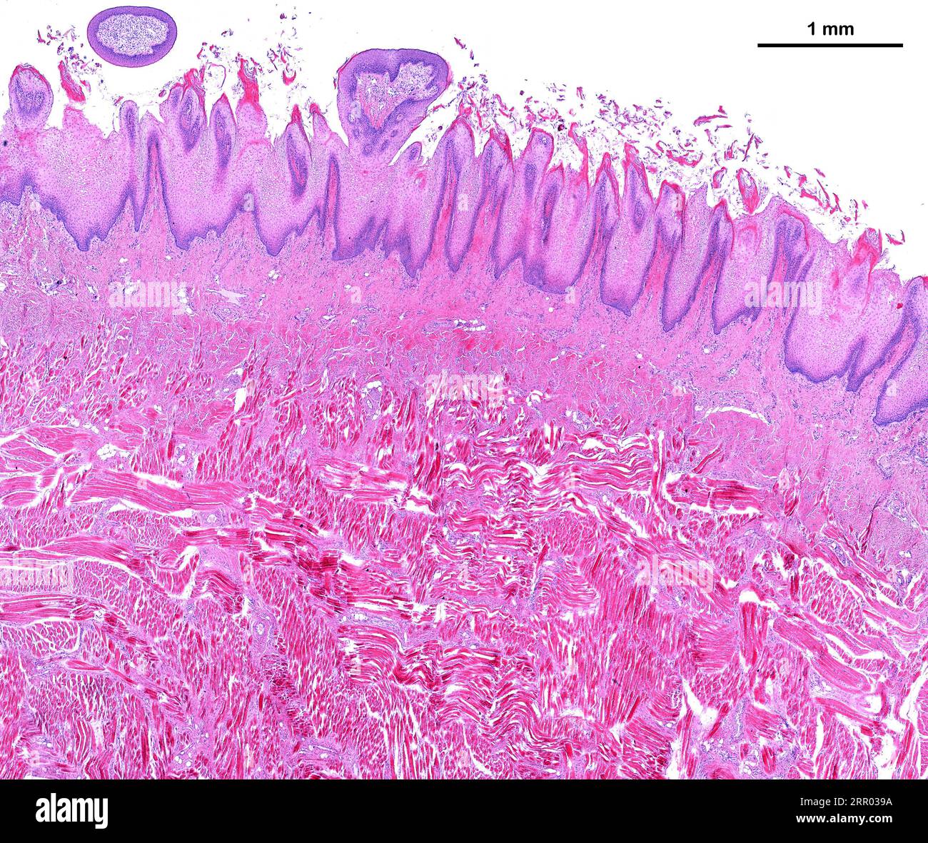 Human tongue filiform papillae, light micrograph Stock Photo - Alamy